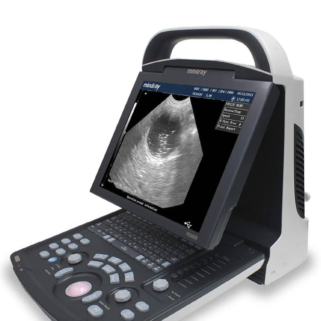 Ultrasonido portátil DP-10 Mindray - Sel equipo médico